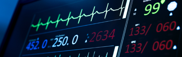 Premature Ventricular Contractions (PVCs): Causes, Symptoms, Diagnosis ...